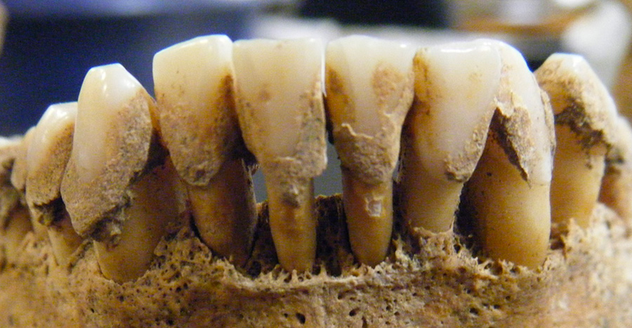 Seminari “Ancient Human Dental Calculus under the Microscope” (19, 20 ...